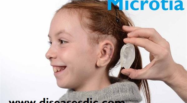 Microtia – Causes, Treatment, and Complications.