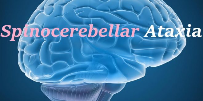 Spinocerebellar Ataxia (SCA) – Definition, Causes, and Treatment.