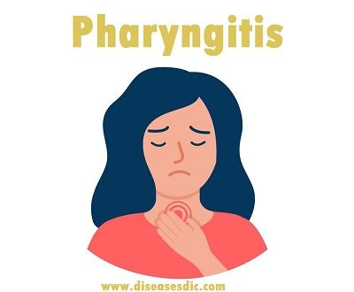 Pharyngitis – Types, Causes, Risk Factors and Treatment