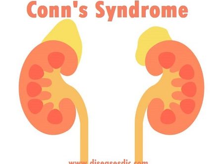 Conn's Syndrome – Types, Complications and Risk factors