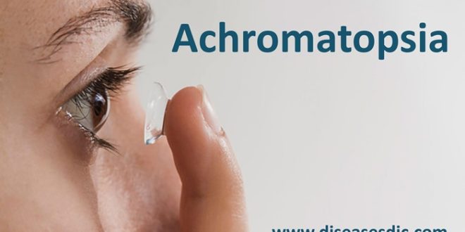 Achromatopsia – Types, Complications and Prevention
