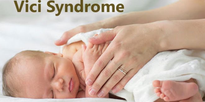 Vici Syndrome – Causes, Treatment and Prevention