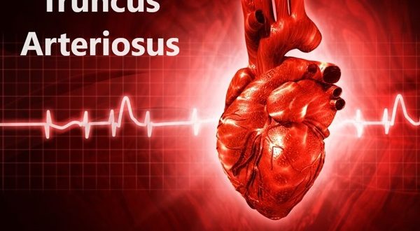 Truncus Arteriosus – Types, Causes and Prevention